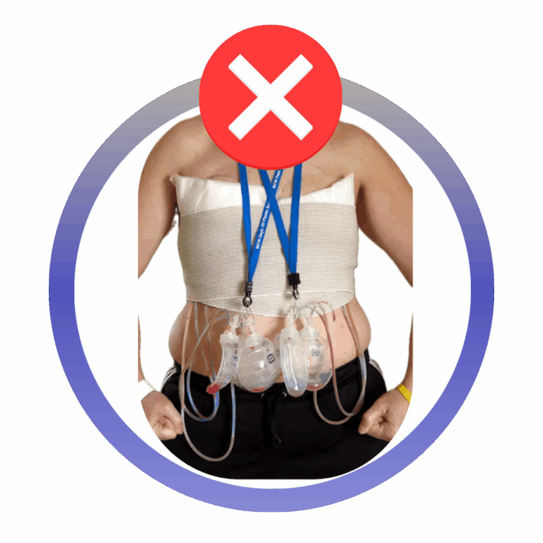 Simplify Recovery: SOMAVAC® Post-Surgical Drain System